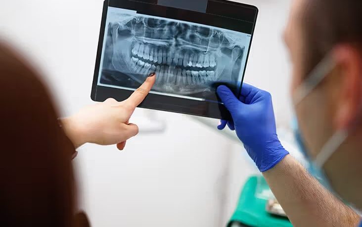 Types of Dental X-Rays: Definition and Explanation | Your Talk ...